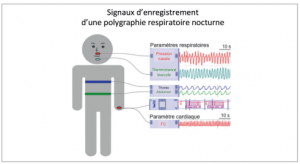 Polygraphie respiratoire nocturne – sfrms-app